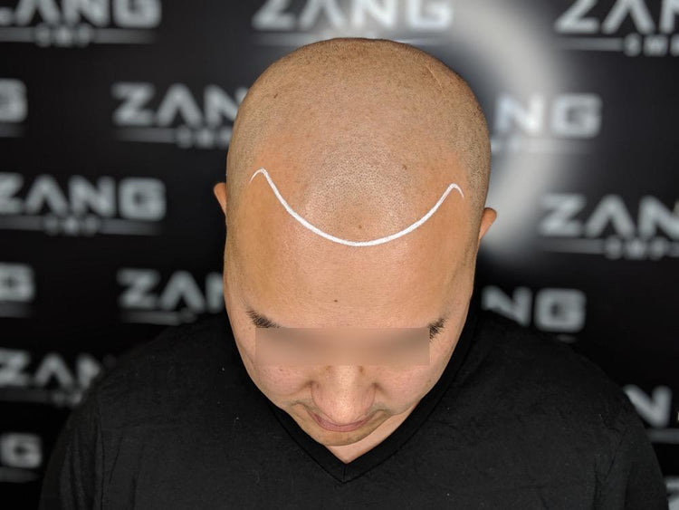 Customizing Your Look: SMP Hairline Styles Decoded – Zang SMP